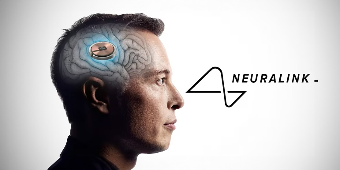 Elon Musk's Brain Implant, Neuralink, Receives FDA Approval for Human ...