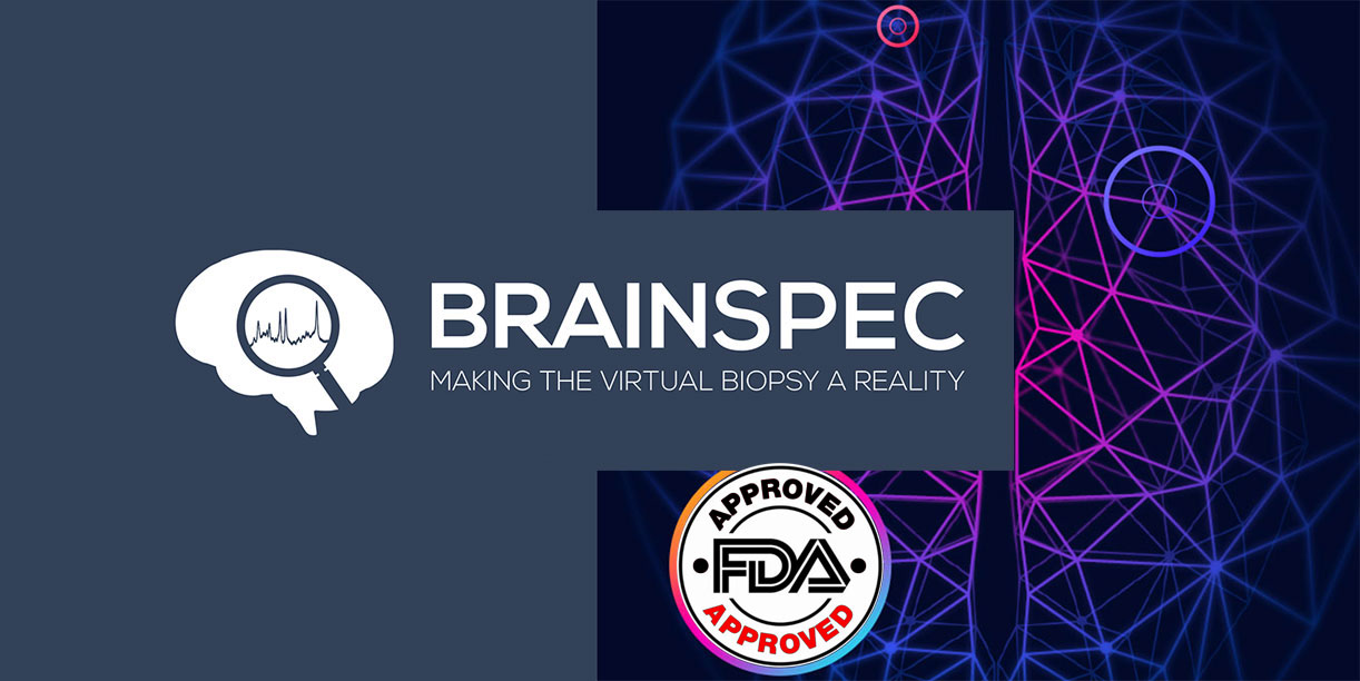 FDA Clears BrainSpec's AI-Powered MRS Platform for Brain Disease Diagnosis