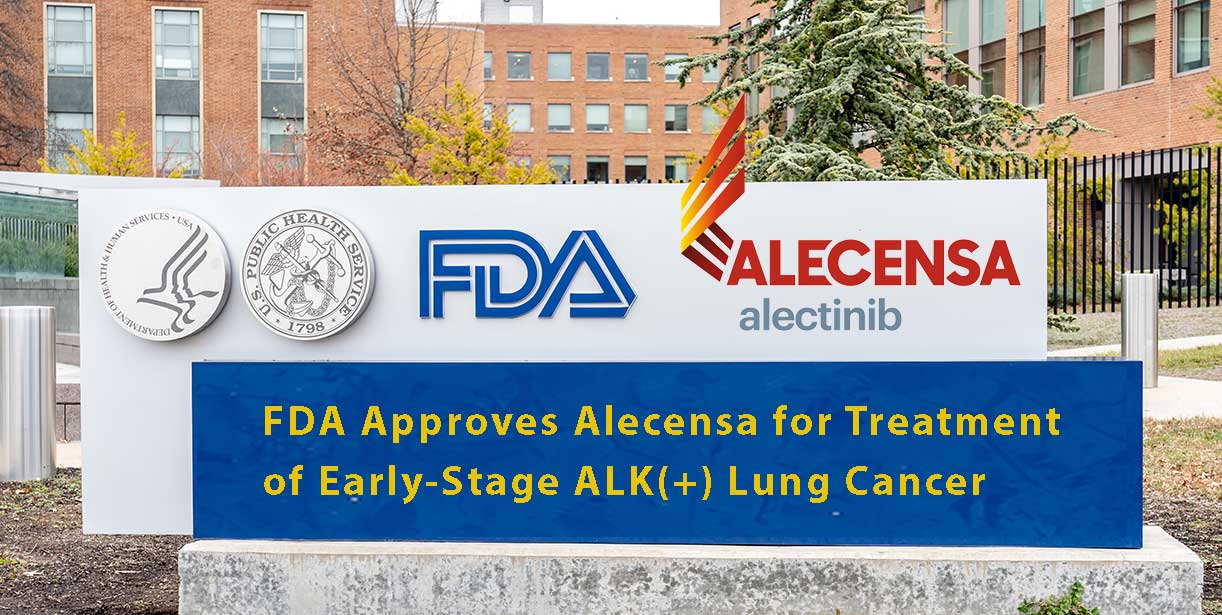 FDA Approves Alecensa for ALK+ Lung Cancer Following 76% Drop in Risk ...
