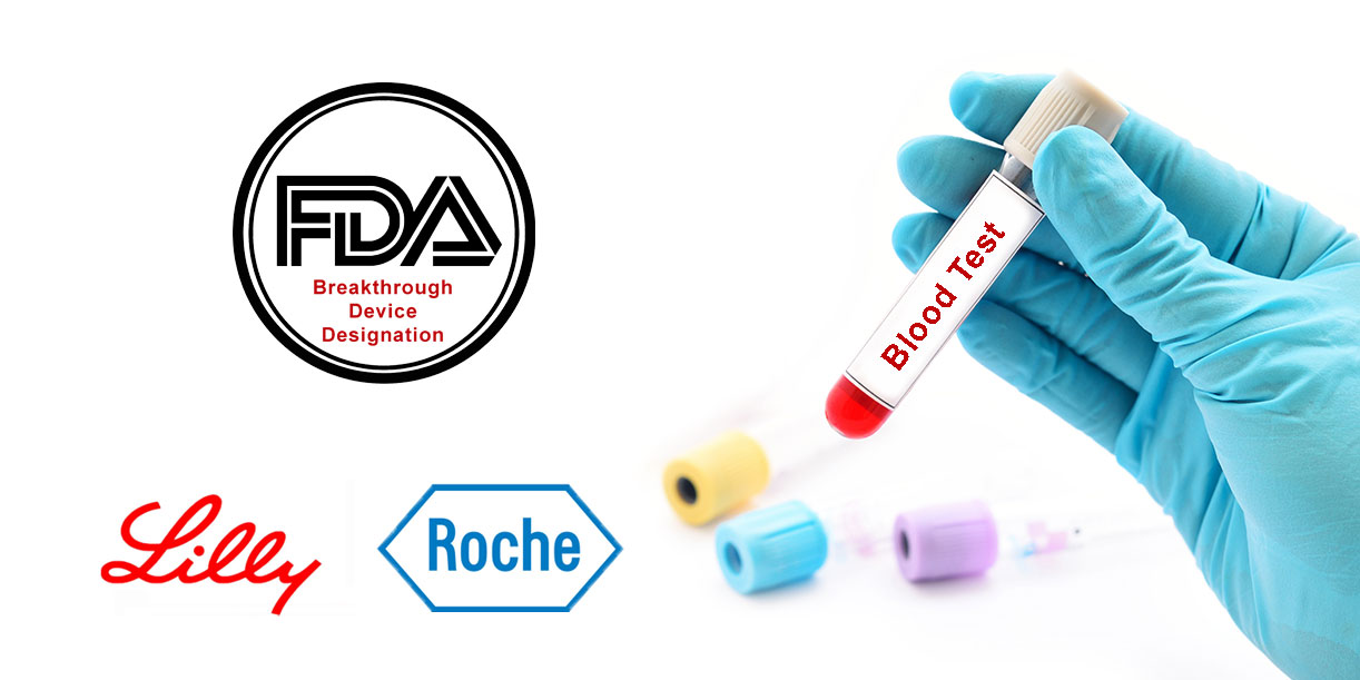 Roche's Blood Test for Alzheimer's Earns FDA Breakthrough Device ...