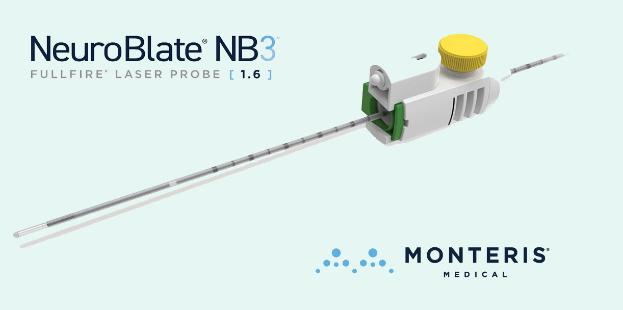 Monteris Introduces Smallest NB3 Laser Probe for Brain Tumor Surgery