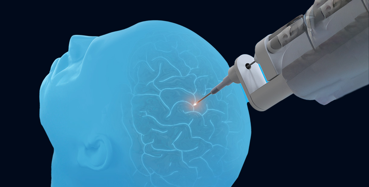 Elevating Safety and Efficacy in Brain Tumor Treatment with the NB3 ...