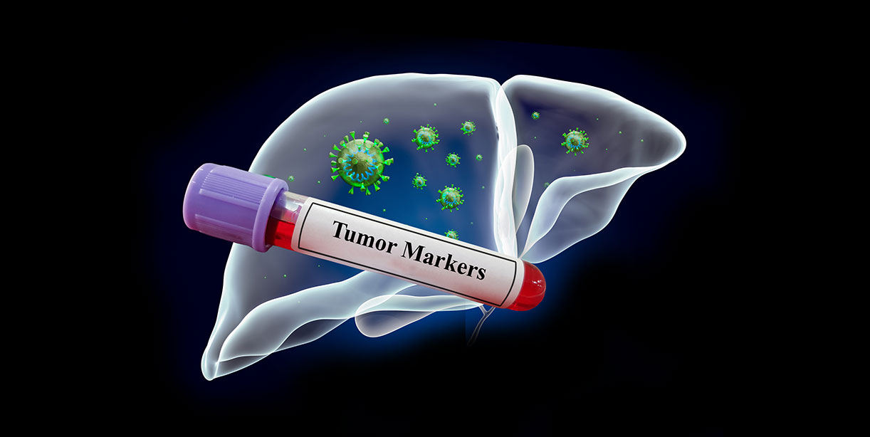 Targeting NBR1: New Biomarker Could Predict Immunotherapy Success in ...
